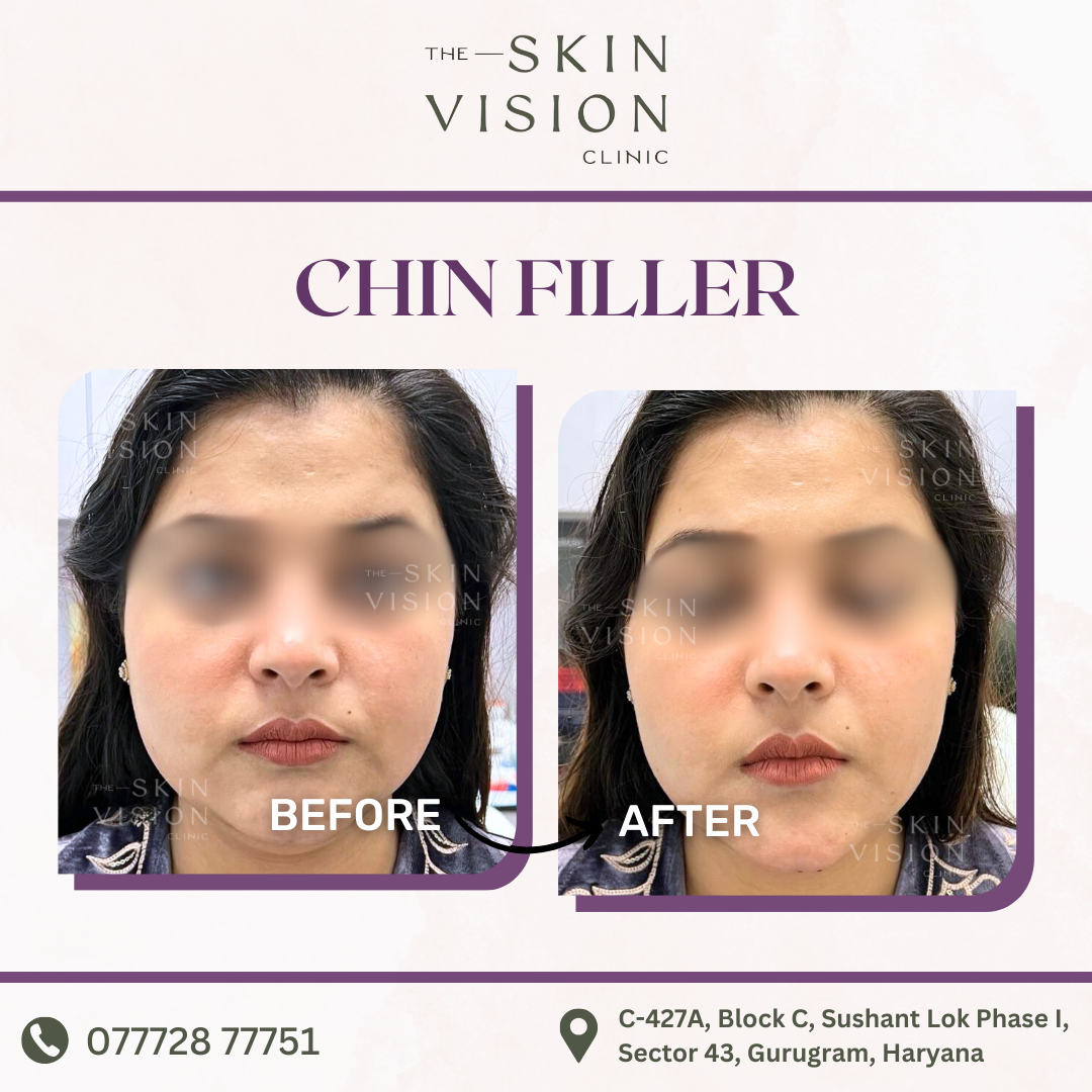 Infinite Scroll | The Skinvision Clinic